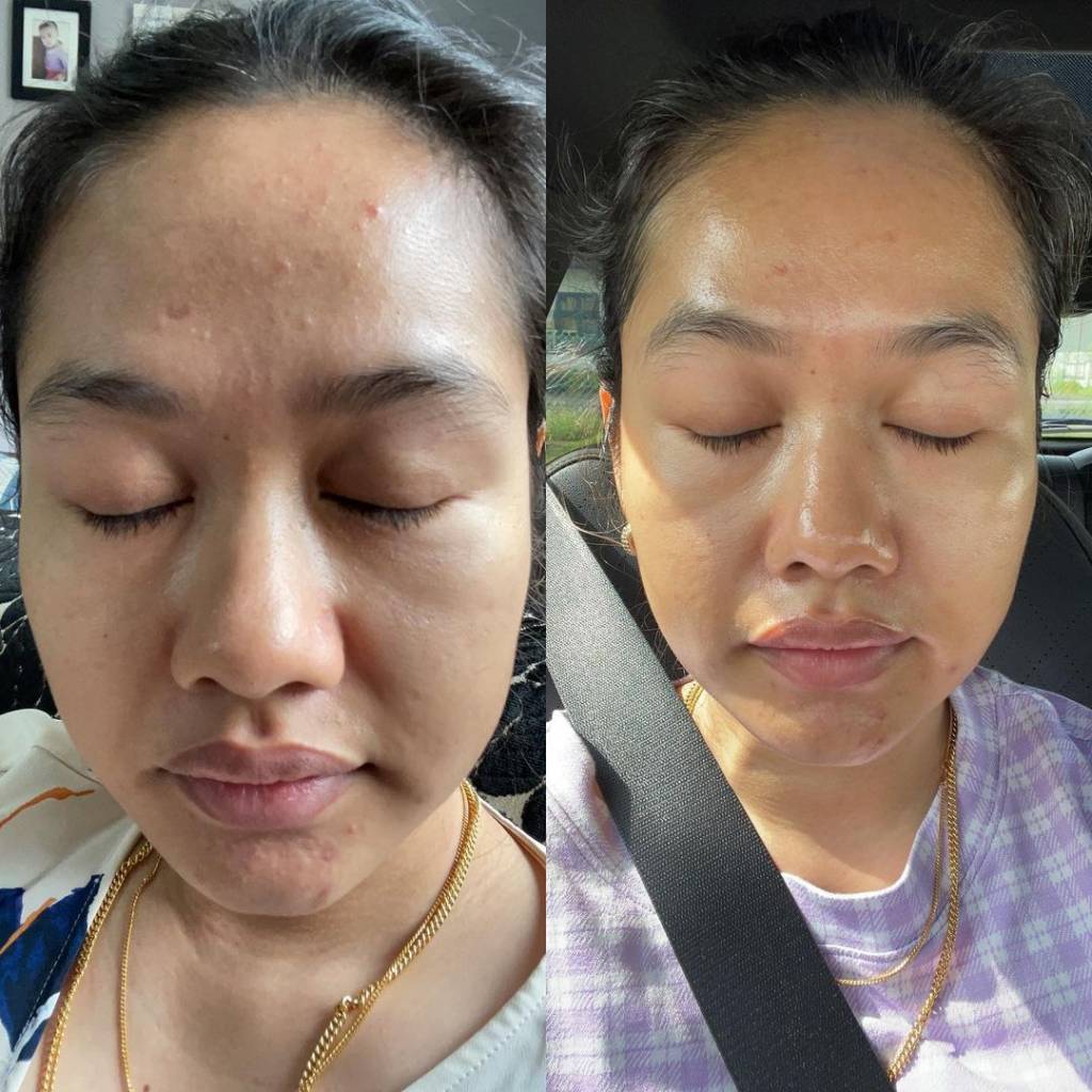 Gallery - MyClinic | Aesthetic Clinic Malaysia