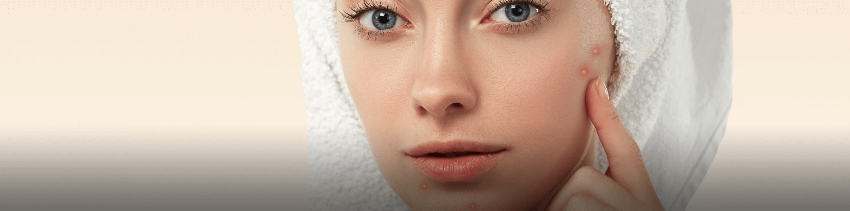 PRP (Platelet Rich Plasma) - MyClinic | Aesthetic Clinic Malaysia