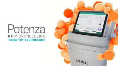 Potenza RF Microneedling - MyClinic | Aesthetic Clinic Malaysia