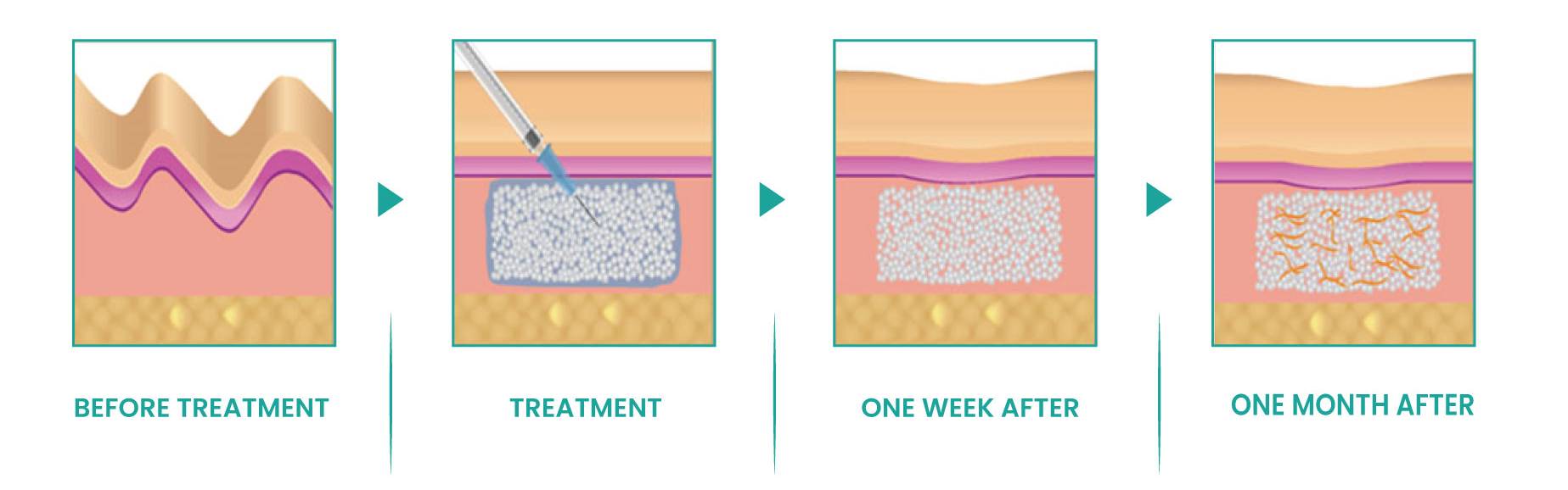 AestheFill - MyClinic | Aesthetic Clinic Malaysia