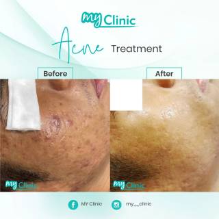 MyClinic | Aesthetic Clinic Malaysia