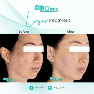 MyClinic | Aesthetic Clinic Malaysia